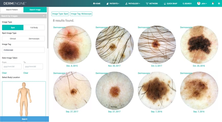 DermEngine | The Most Intelligent Dermatology Platform